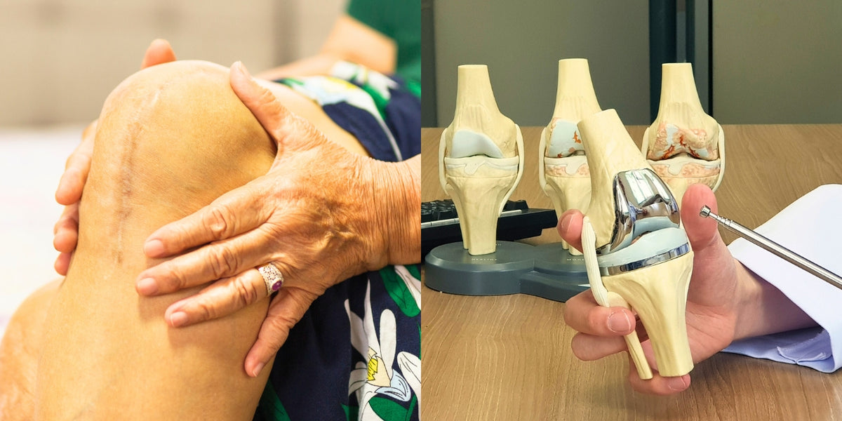Top 10 Most Useful Equipments For Post Knee Surgery — iElder.Asia ...